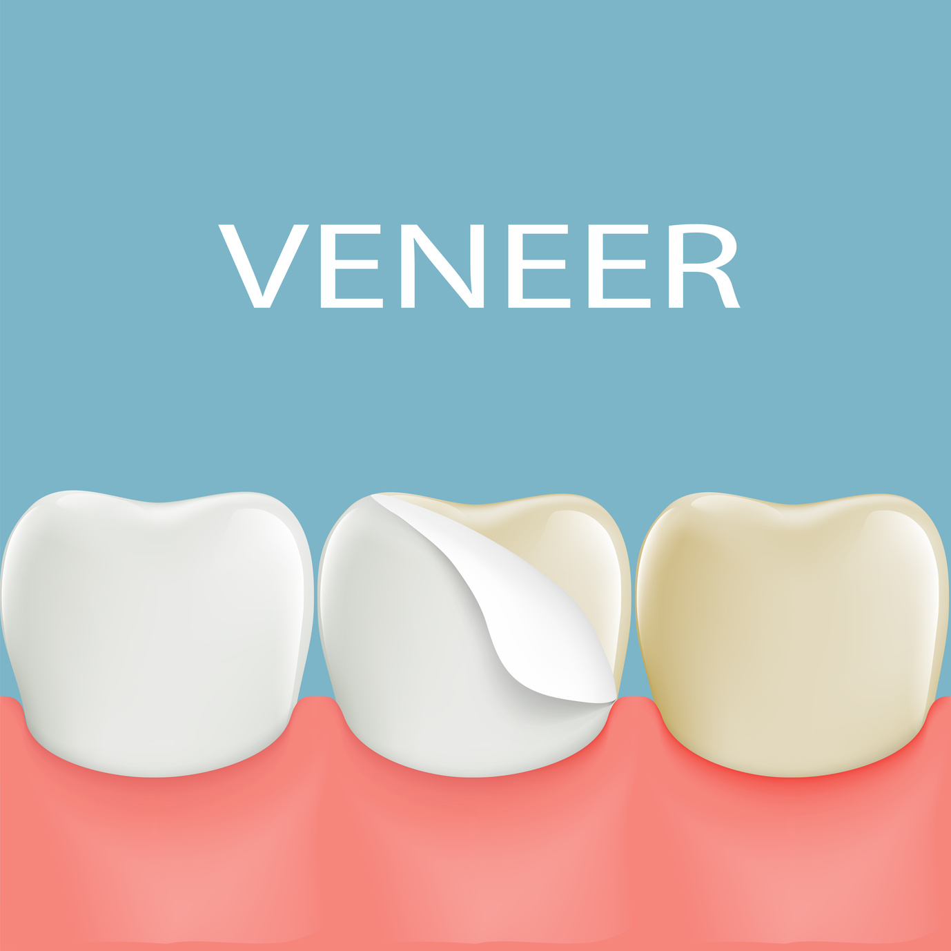 How can Cosmetic Porcelain Veneers change your smile?